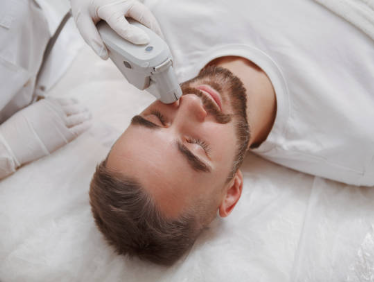 Epilation Définitive Laser Homme Visage - Divin'Addict